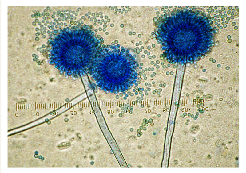 Hidden Mold: What to Do When You Can't See Mold, but Still Suspect a ...