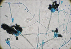 How Mold Grows in Your Home- Optimum Mold Growth Conditions . Mould Facts